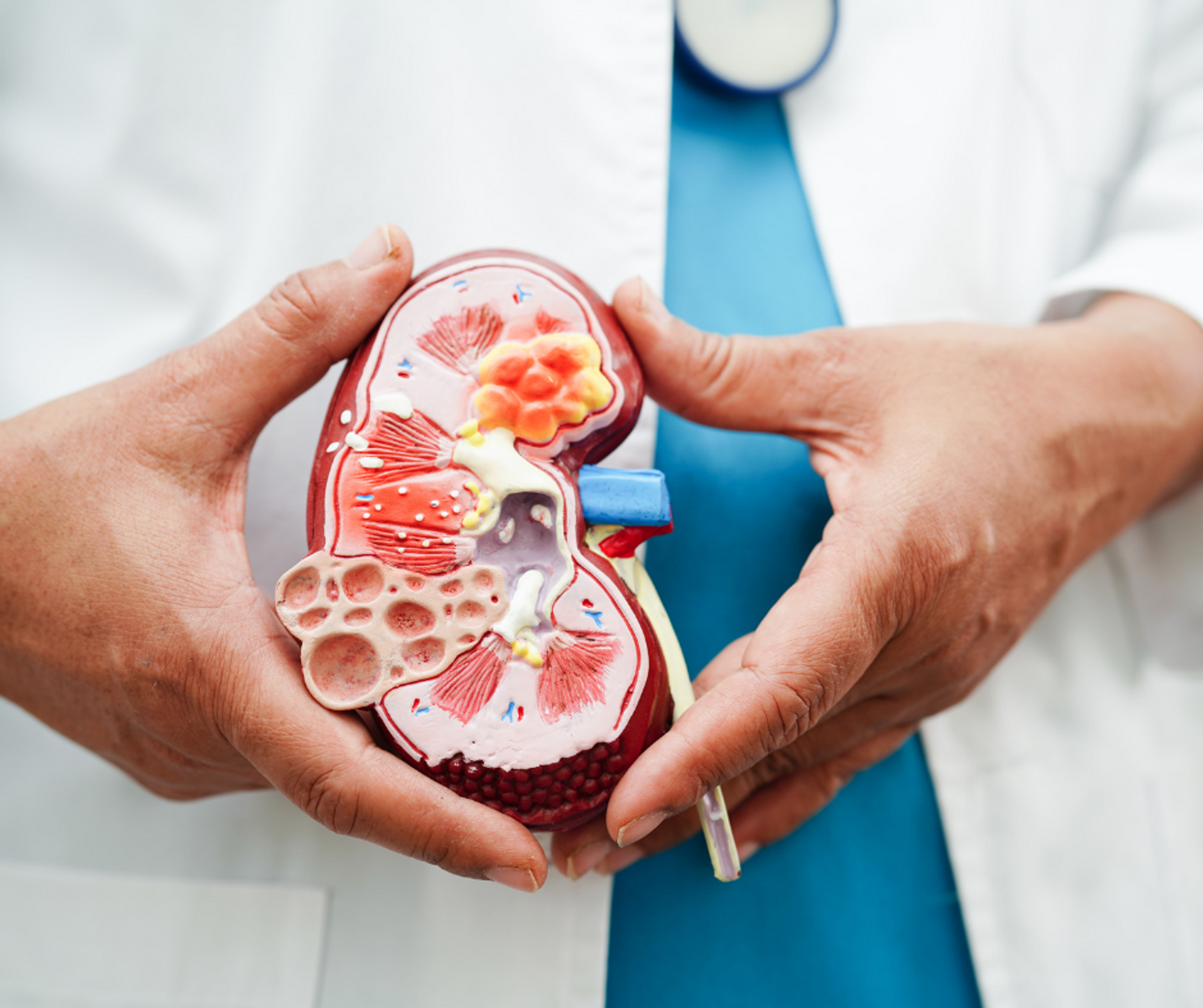 Centrum urologie, klinika ISCARE, Praha 9 | ISCARE