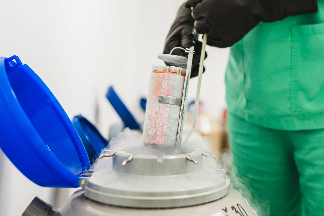 Zamrazení spermií | ISCARE