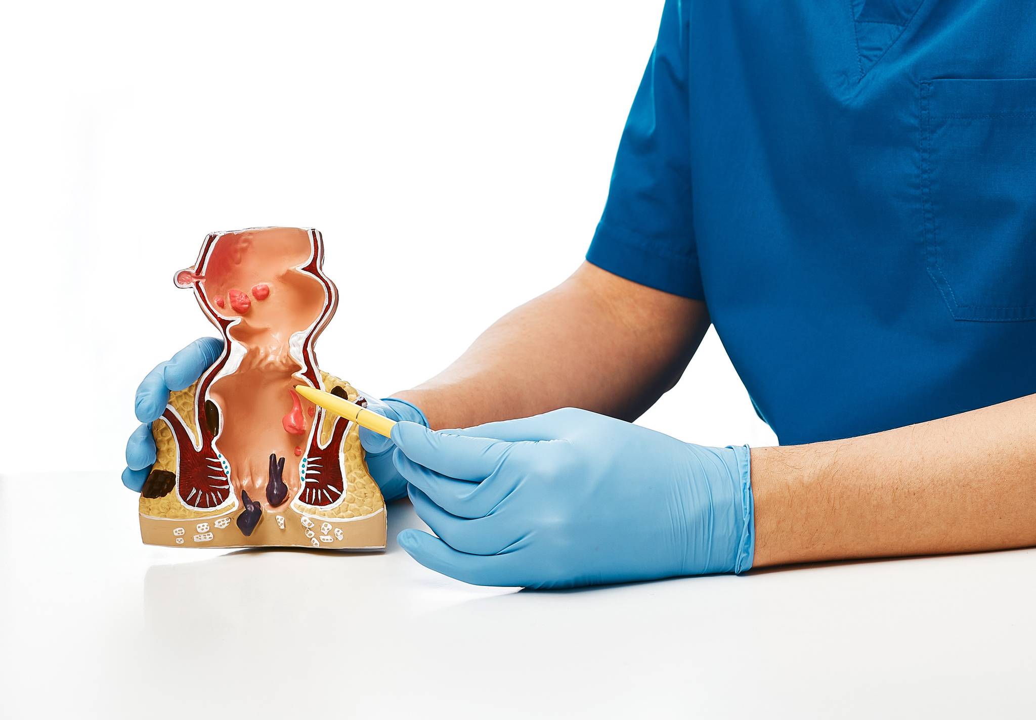 Proktologie I klinika ISCARE I Praha 9 | ISCARE