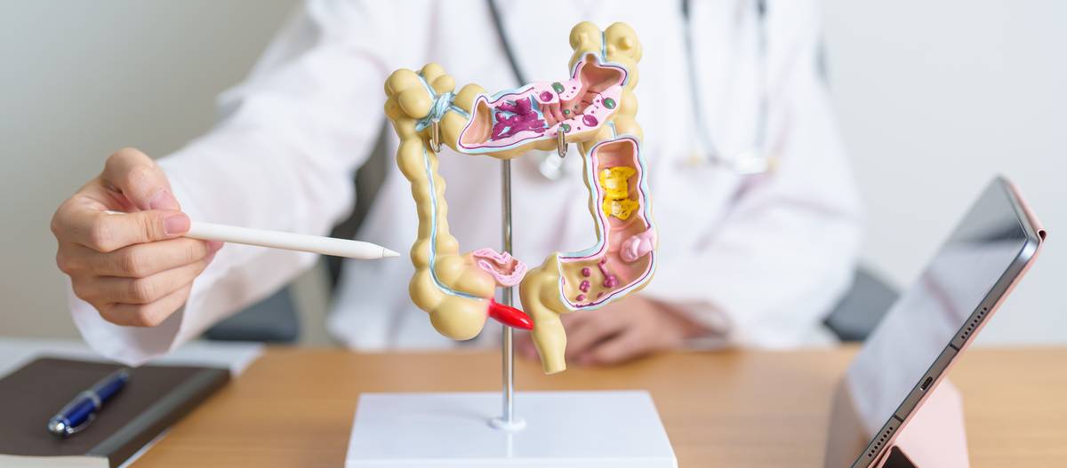 Proktologie I klinika ISCARE I Praha 9 | ISCARE